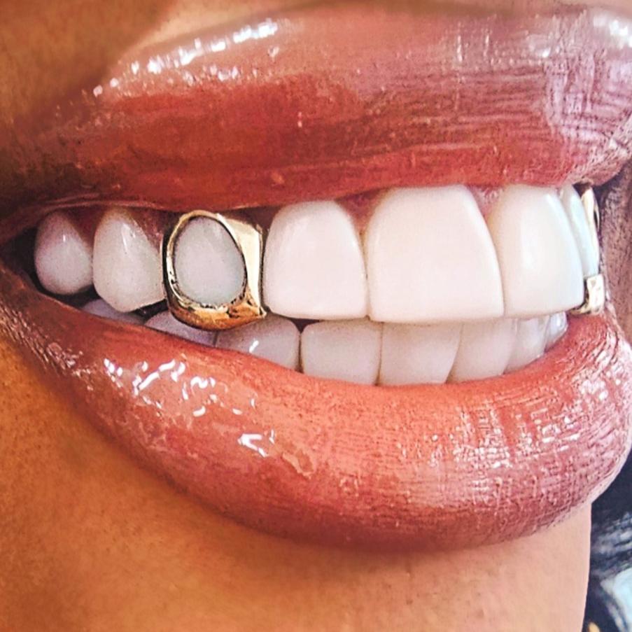 Single Window Gold tooth, grillz, open face grill – London Grillz