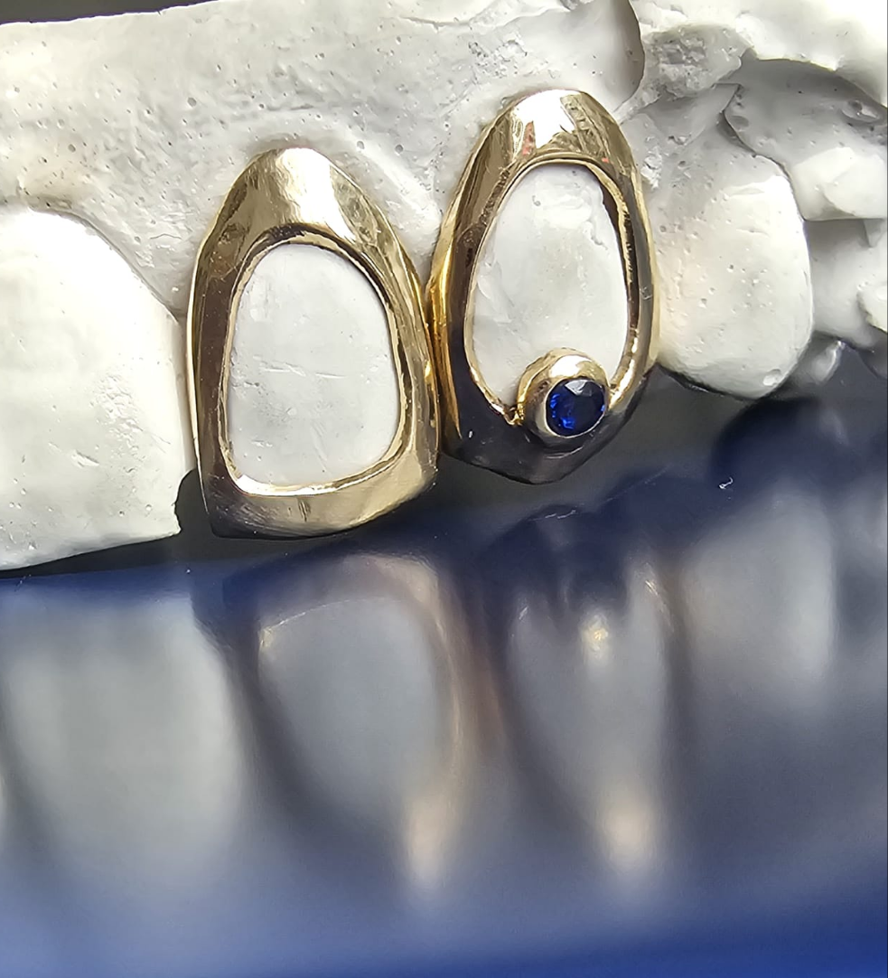 window-and-heart-cap, grillz, silver caps – London Grillz