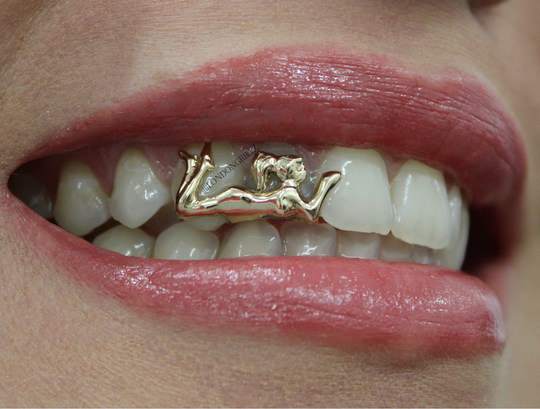 Window and solid cap set, grillz, silver caps – London Grillz