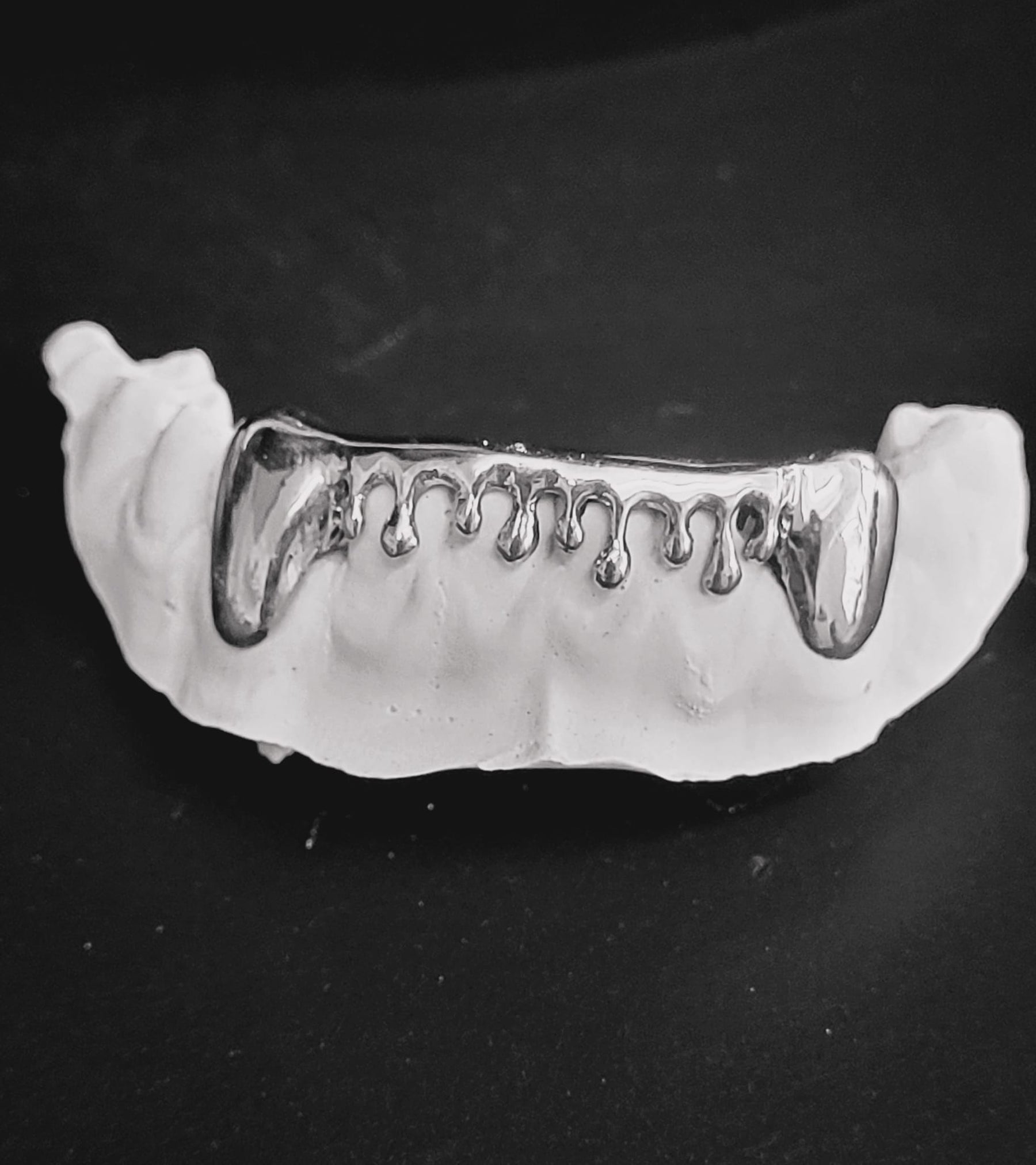 Drip bar design gold drip grillz – London Grillz