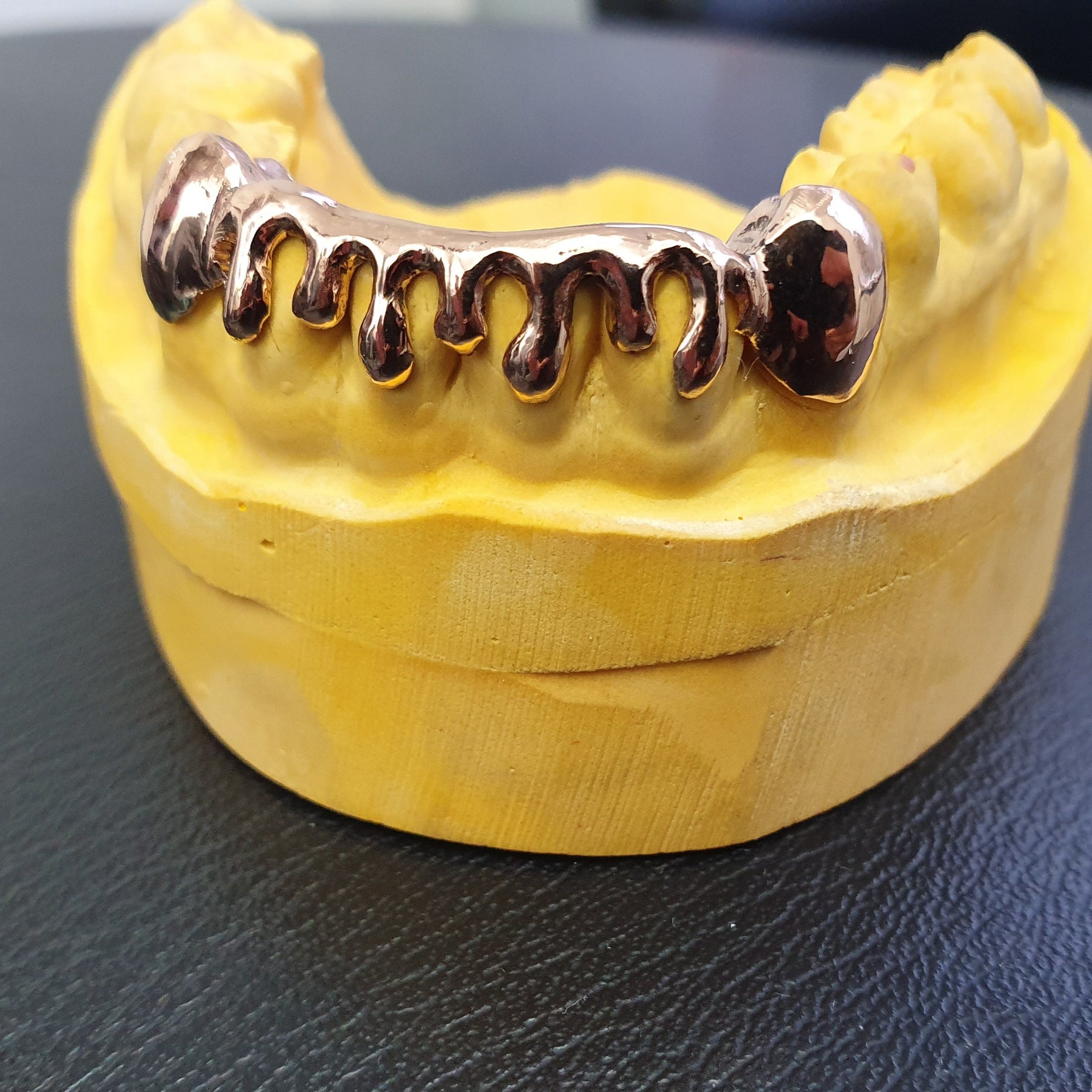 Drip bar design gold drip grillz – London Grillz