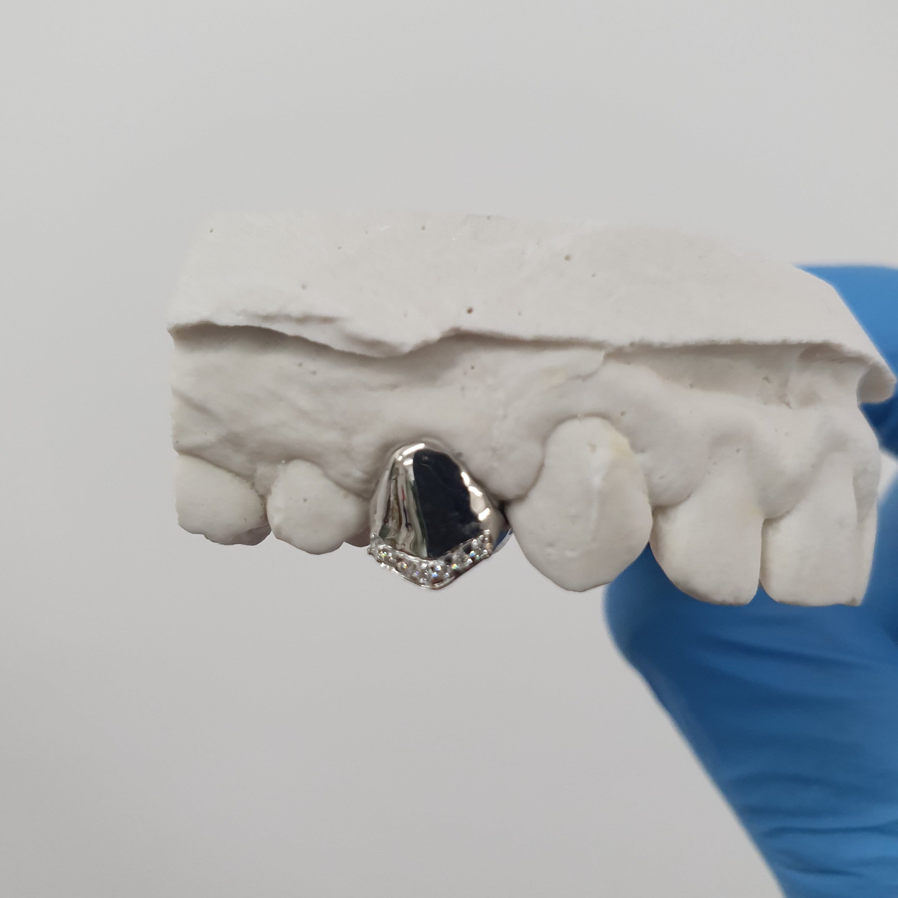 Platinum Teeth Caps Metal Porcelain Crowns Dental Centre In Turkey