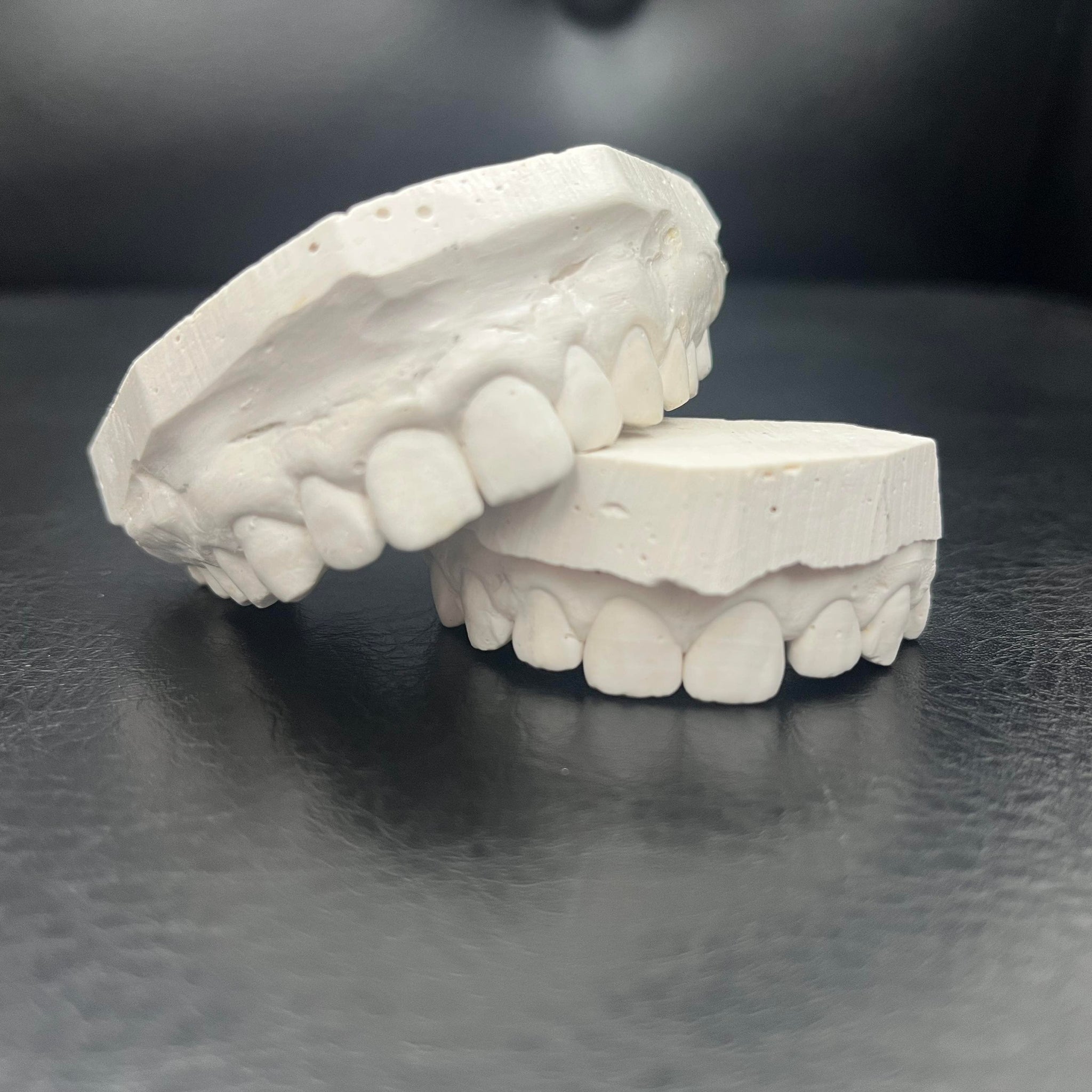 Extras – London Grillz
