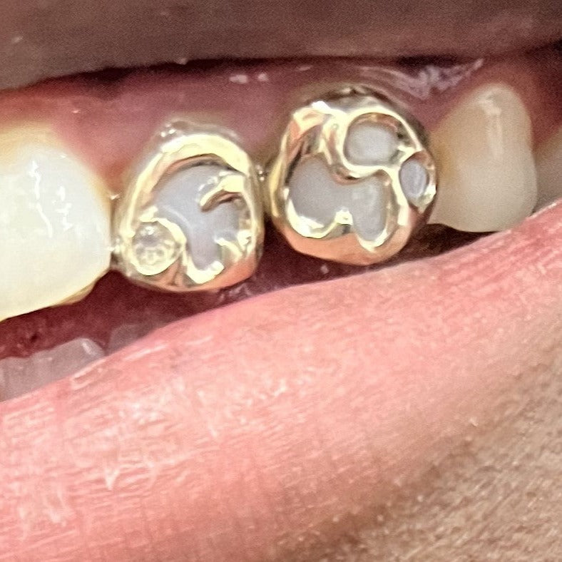 Products – London Grillz