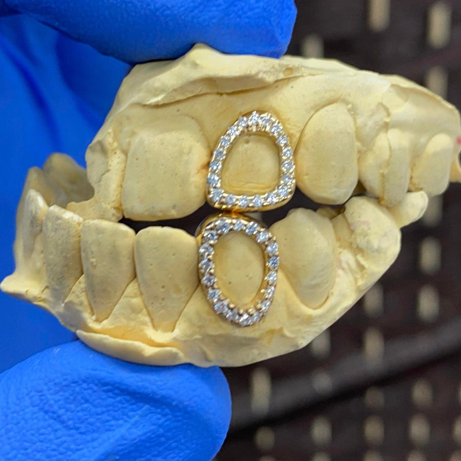 Products – London Grillz