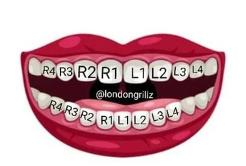 Window with diamond inlay design, grillz, Diamonds – London Grillz