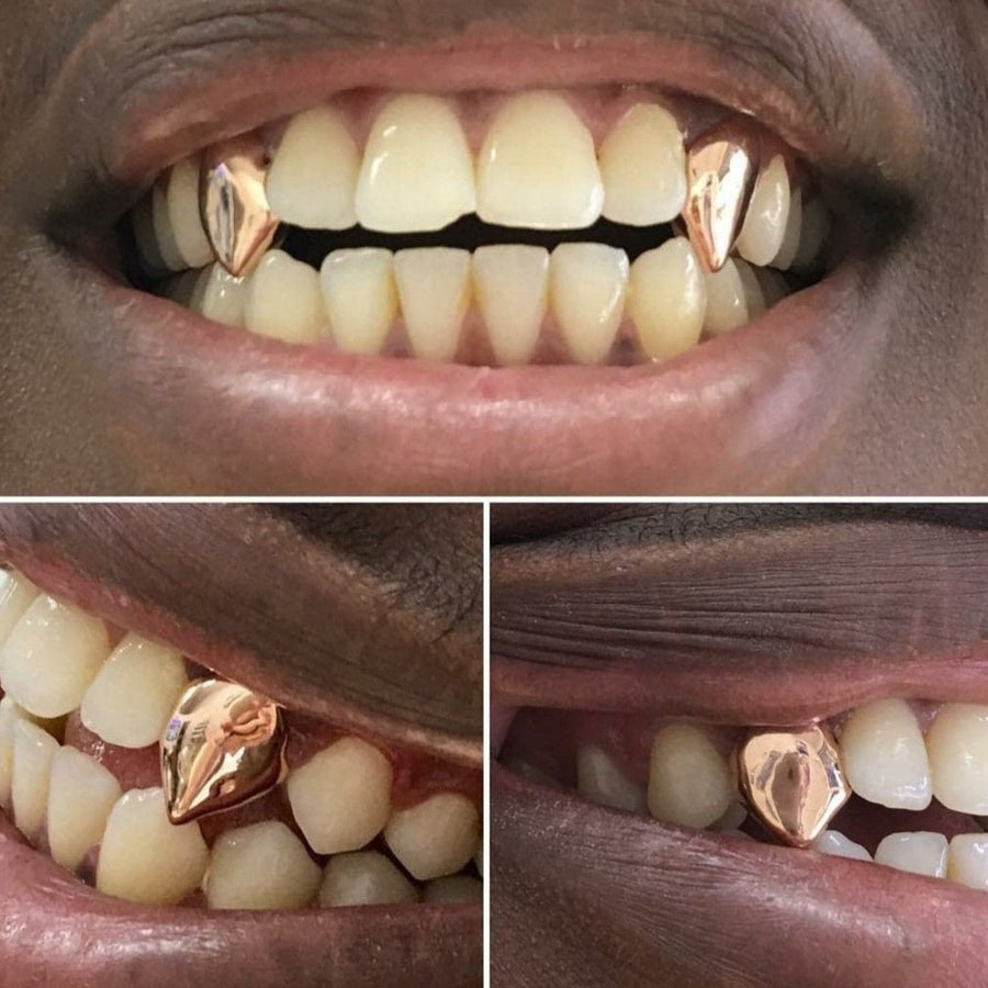 Browse all Grillz – London Grillz